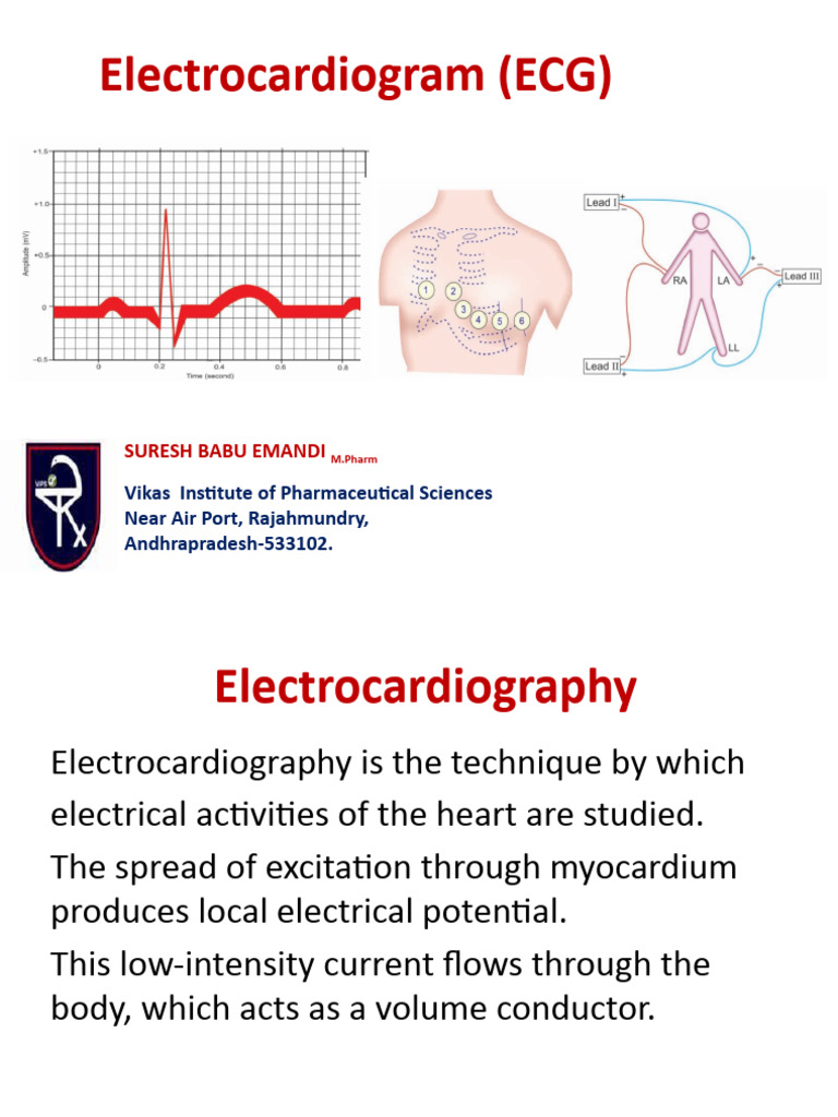 Ecg or Electro Cardiogram and Electrocardiograph | Download Free PDF ...