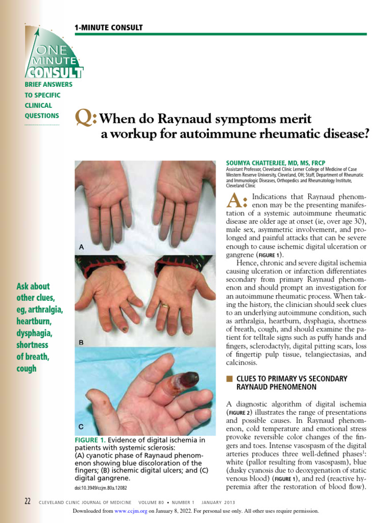 When Do Raynaud Symptoms Merit A Workup For Autoimmune Rheumatic ...