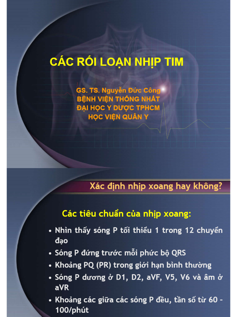 ECG CÁC RỐI LOẠN NHỊP TIM [Compatibility Mode] | PDF