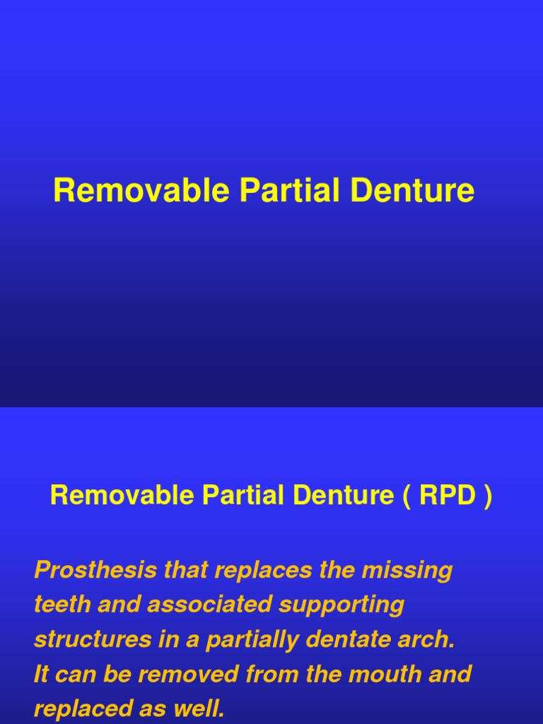 Alginate Presentation RPD | PDF