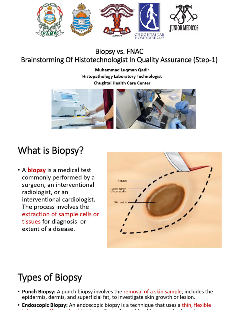 Biopsy vs FNAC | PDF | Biopsy | Staining