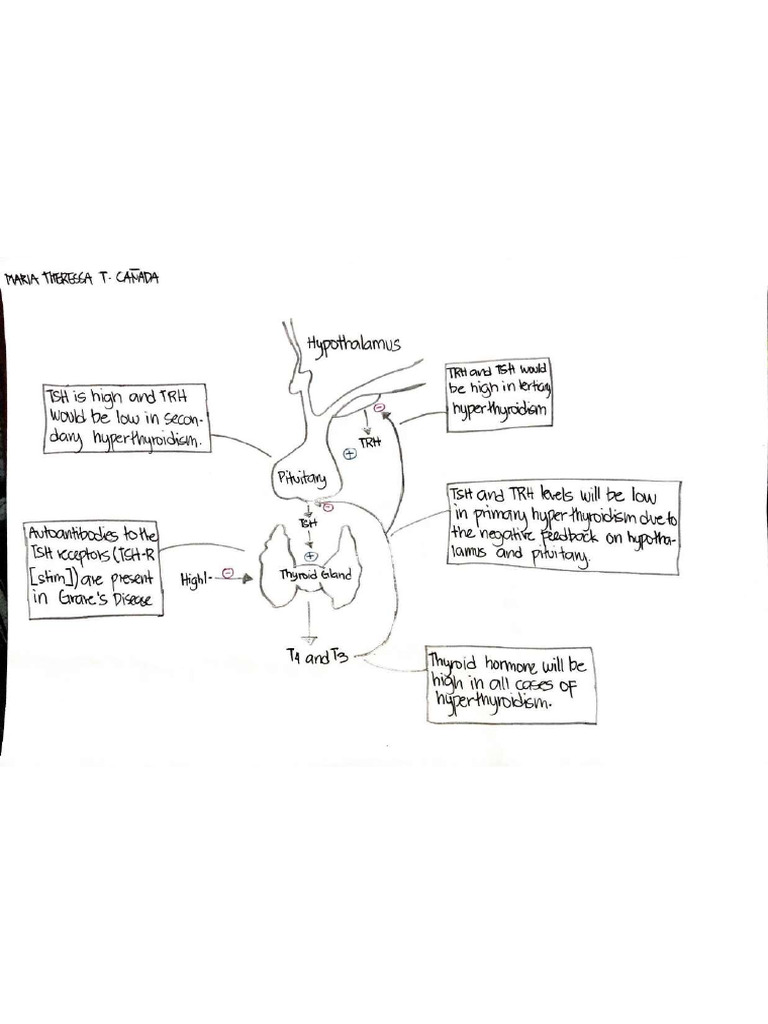 HYPERTHYROIDISM | PDF