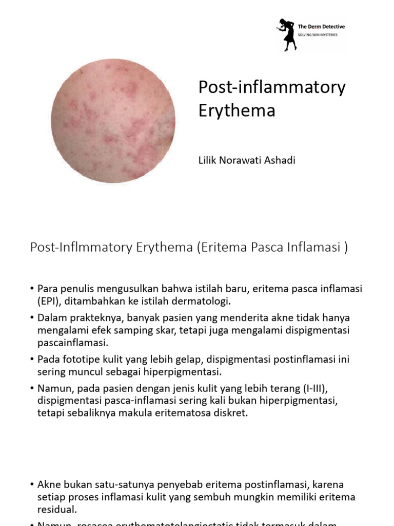Eritema Pasca Inflamasi: Definisi dan Penatalaksanaan | PDF