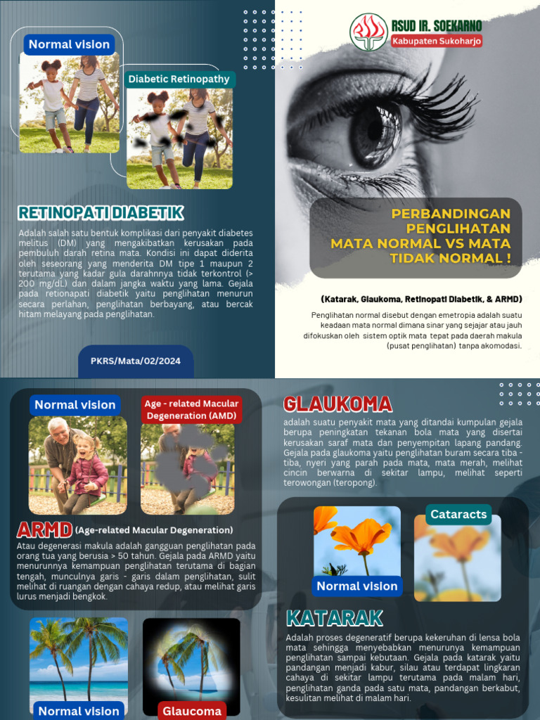 Perbandingan Penglihatan Mata Normal Mata Tidak Normal | PDF