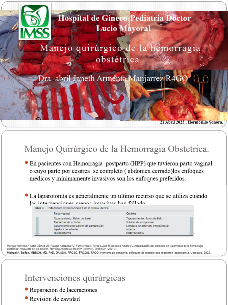 Manejo Quirúrgico de La Hemorragia Obstétrica 2023 | PDF | Periodo posparto | Medicina CLINICA