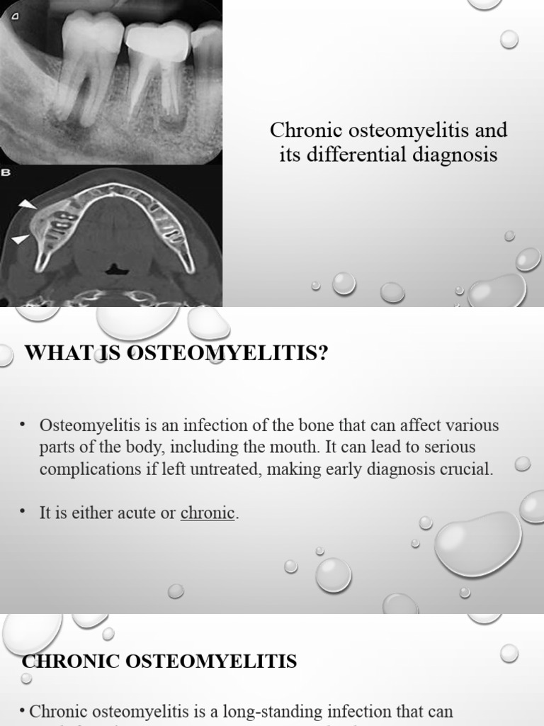 Differential Diagnosis of Chronic Osteomyelitis | PDF | Medicine | Epidemiology