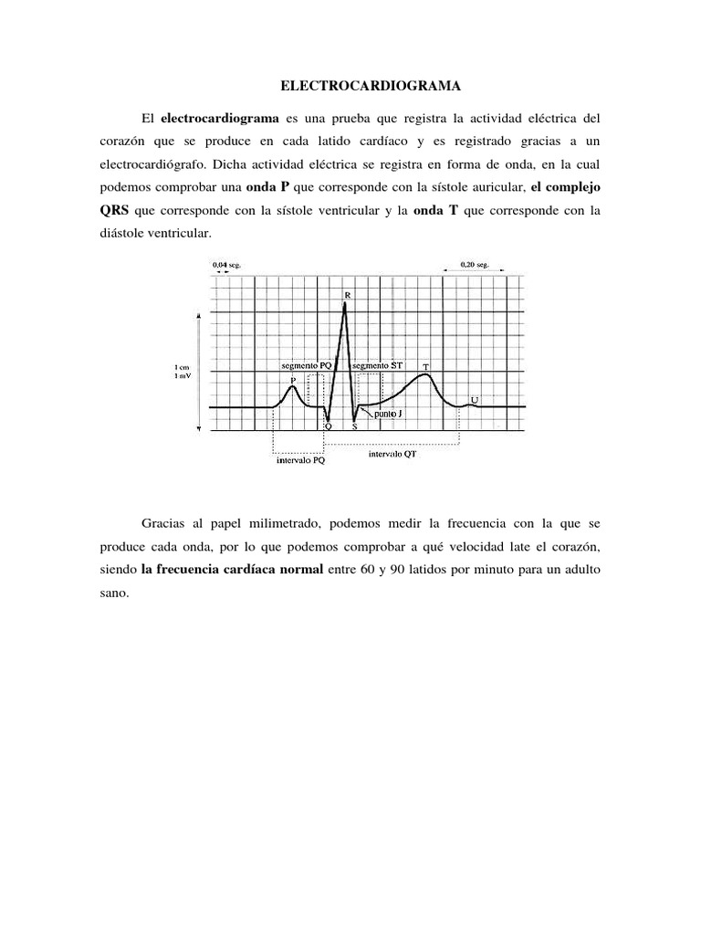 ELECTROCARDIOGRAMA PDF
