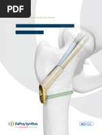 Surgical Technique Guide - RFN-ADVANCED Retrograde Femoral Nailing ...