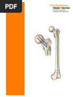 7118-1131 Trigen InterTAN | PDF | Hip | Screw