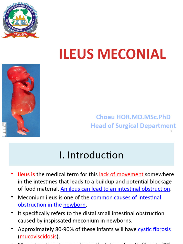 Meconium Ileus in Newborns Explained | PDF | Wellness