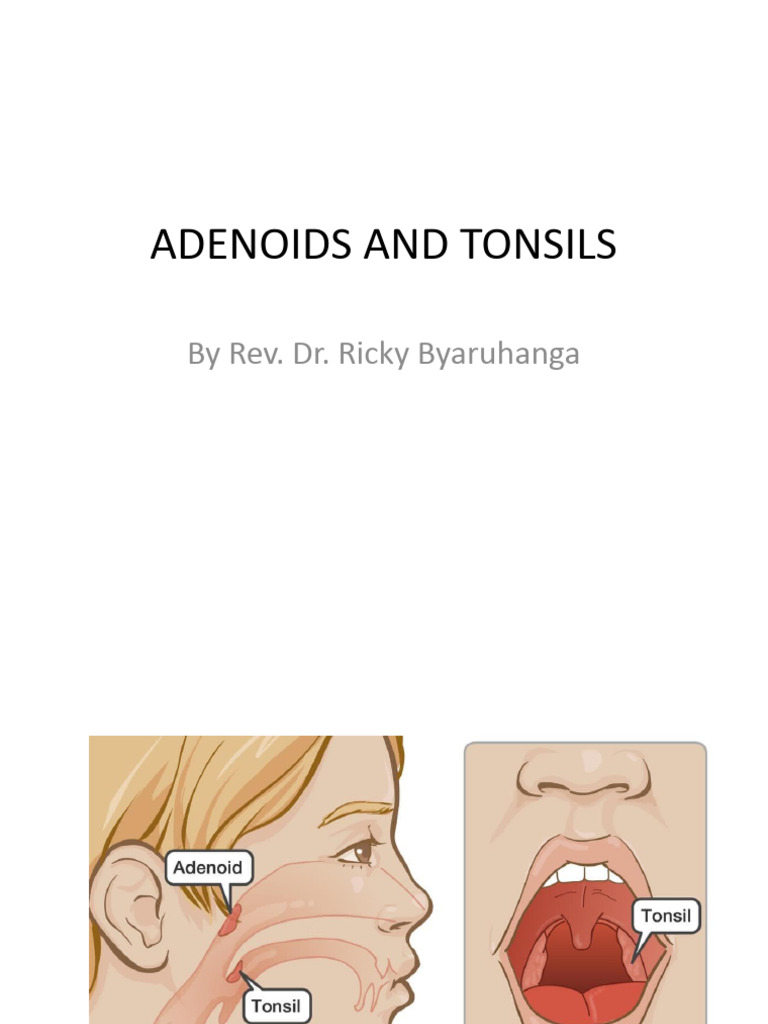 Adenoids and Tonsils | PDF | Animal Physiology | Human Diseases And Disorders
