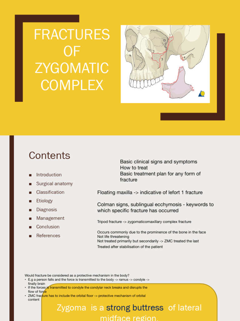 L8 ZMC Fractures | PDF | Anatomy | Human Head And Neck