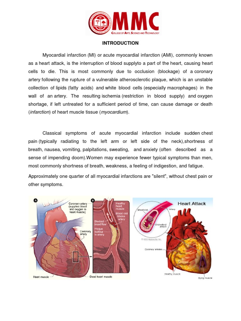 Introduction - MI | PDF | Myocardial Infarction | Atherosclerosis