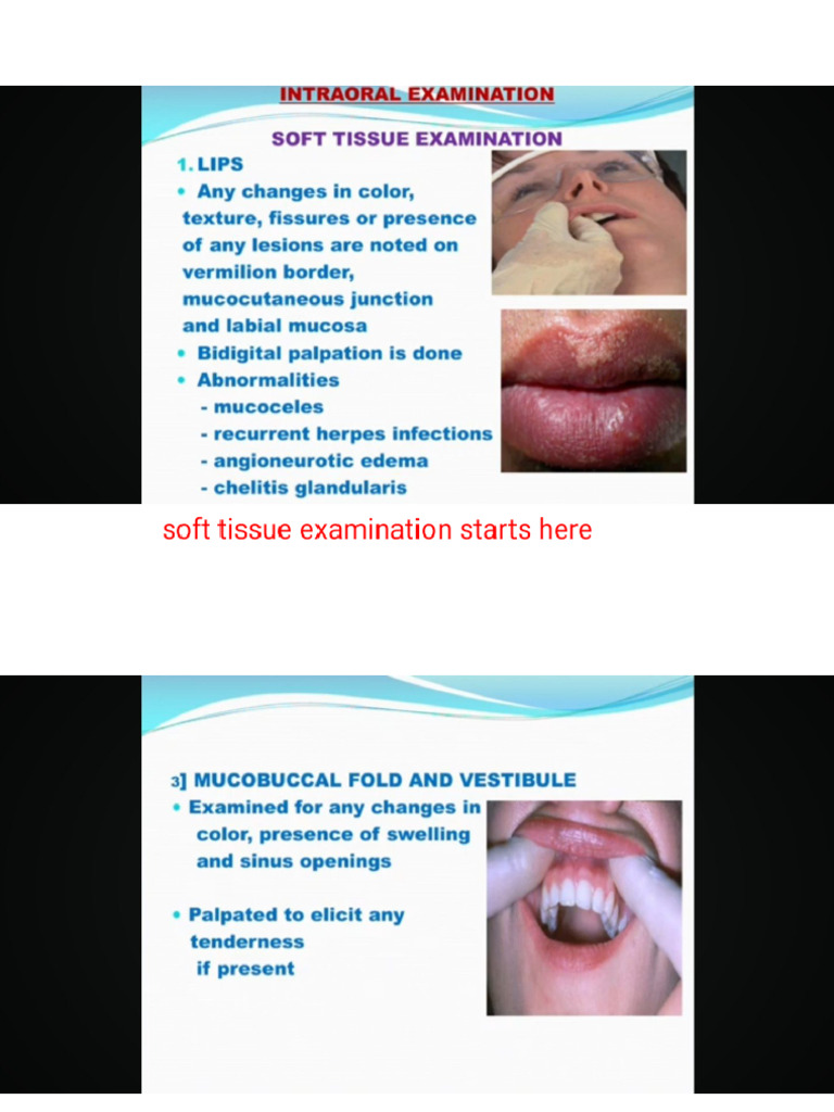 Soft and Hard Tissue Examination | PDF