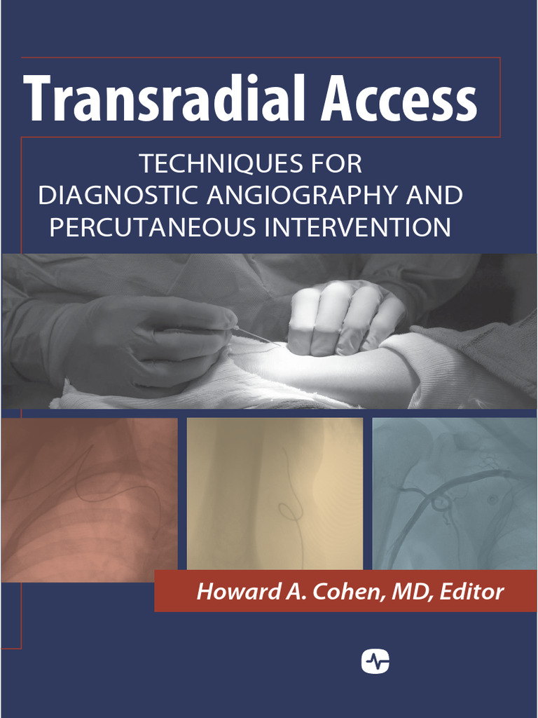Transradial Access Techniques Diagnostic Angiography and Percutaneous ...
