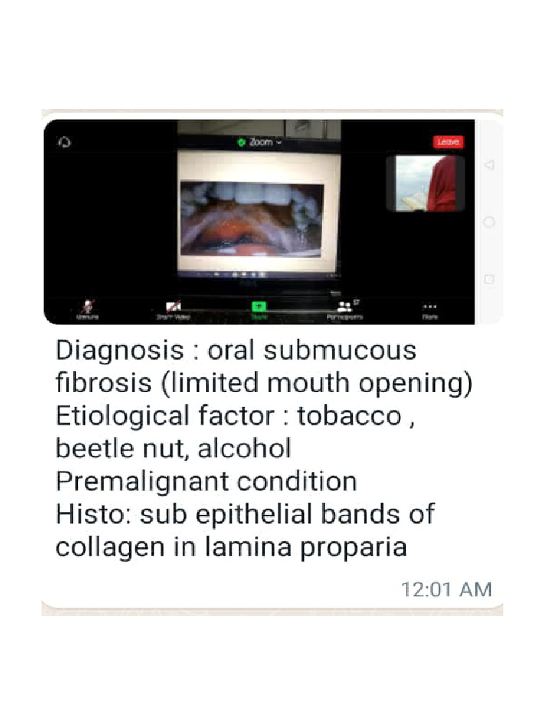 Oral Patho OSPE IMPORTANT | PDF