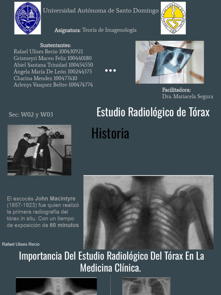 Estudio Radiologico Del Torax | PDF | Radiología | Ct Scan