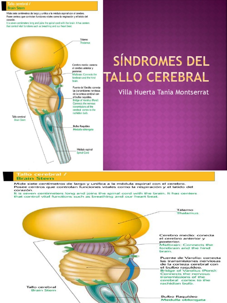 Sindromes Del Tallo Cerebral | PDF | Desórdenes neurológicos | Cabeza y ...