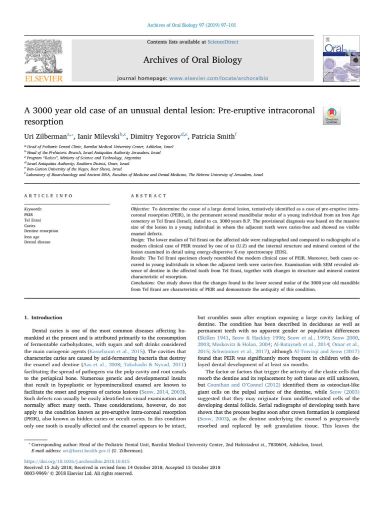 pre eruptive intracoronal resortion | PDF | Human Tooth | Tooth Enamel