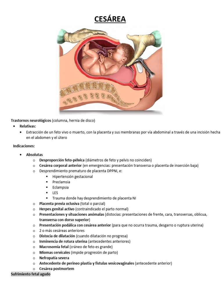 SA-Resumen-Cesárea | PDF | Parto | El embarazo