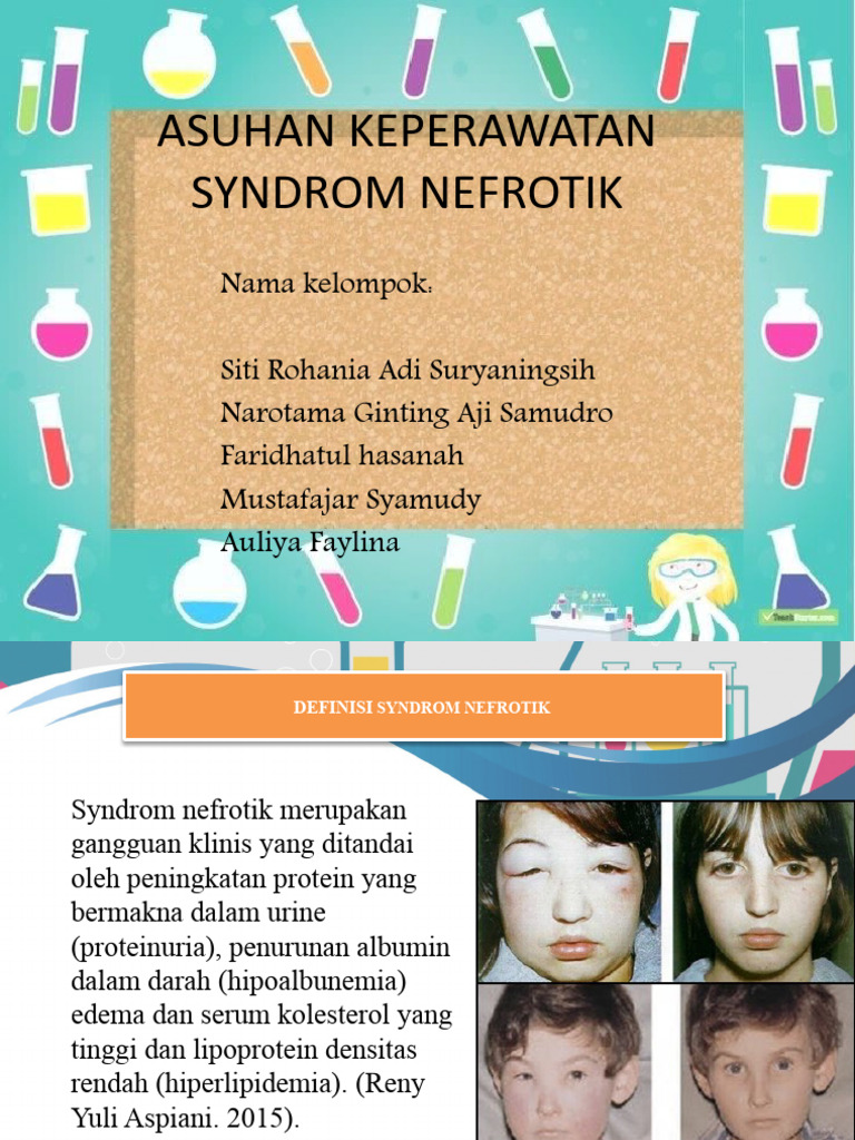 Syndrom Nefrotik | PDF