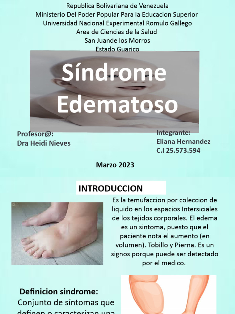 Síndrome Edematoso: Causas y Diagnóstico | PDF | Edema | Medicina