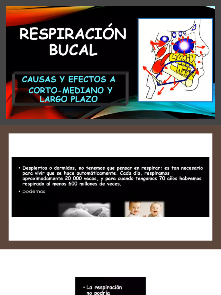 Respiracion Bucal | PDF