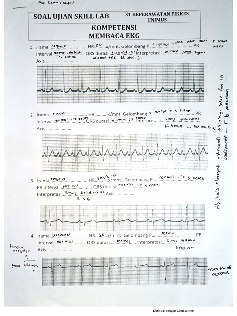 Ekg 1 | PDF