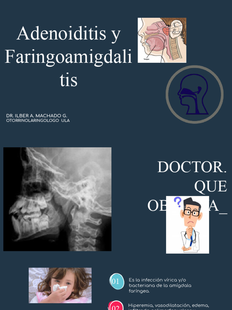 ADENOIDITIS Y FARINGOAMIGDALITIS | PDF | Resfriado comun | Medicina