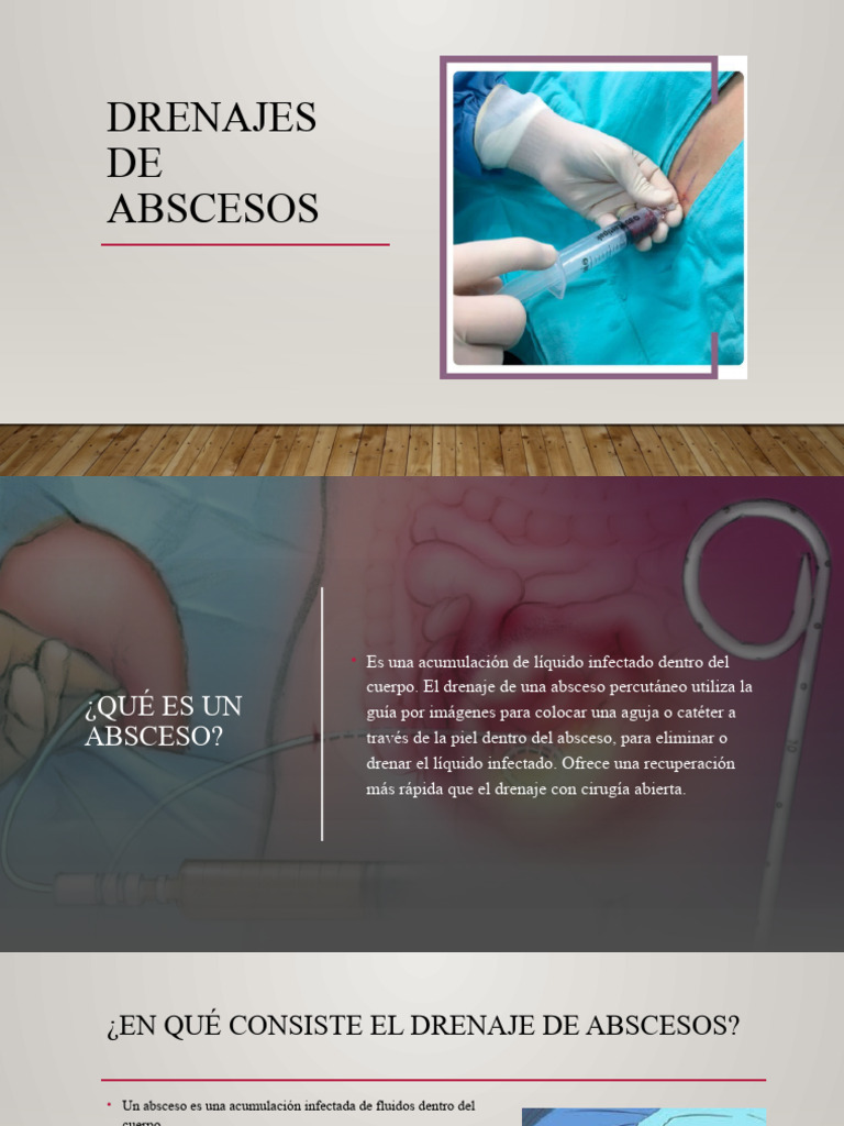 Drenaje de Abscesos | PDF
