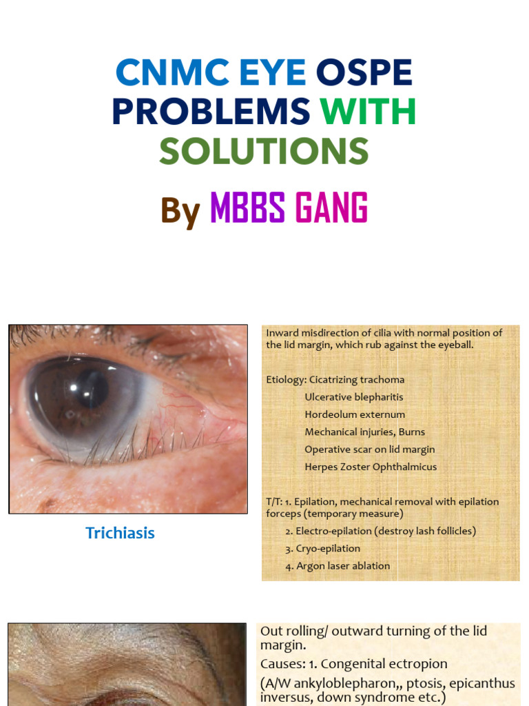 CNMC Eye OSPE Problems With Solutions | PDF | Glaucoma | Cornea
