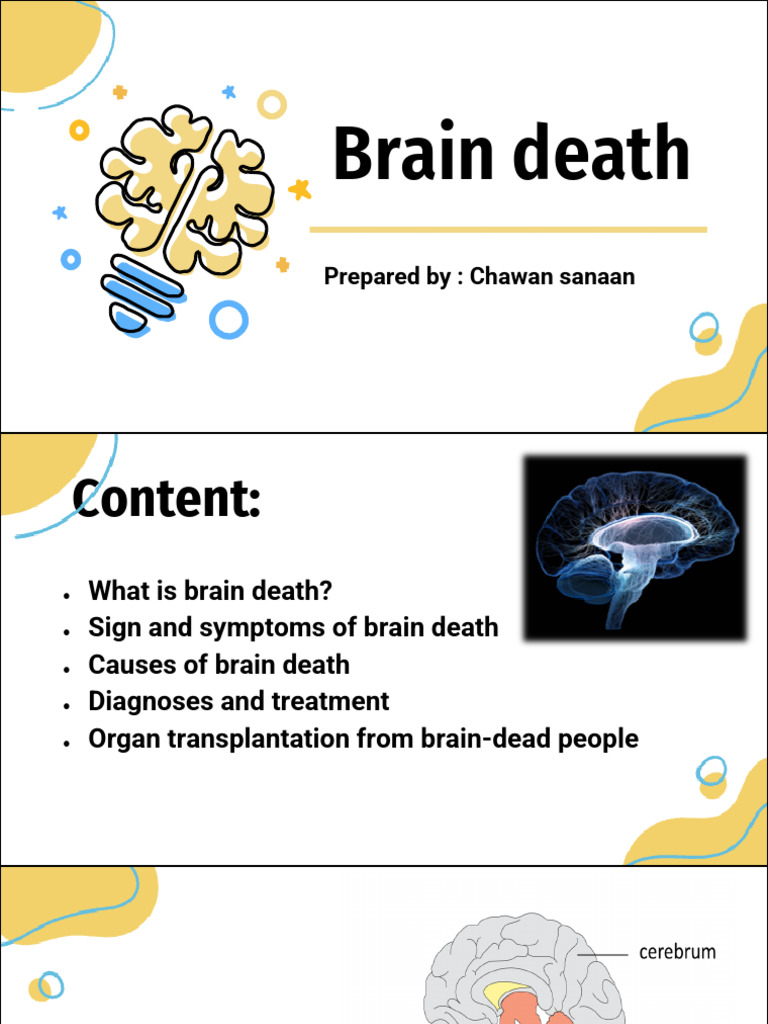 brain death ppt | PDF