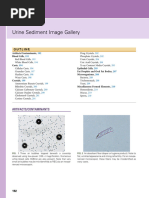 7 - Casts in Urine Sediments | PDF | Clinical Medicine | Kidney