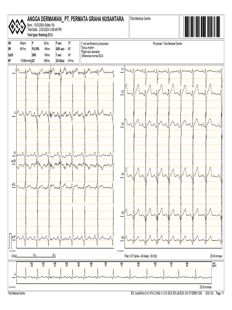 Angga Dermawan - Pt. Permata Graha Nusantara Ecg | PDF ...