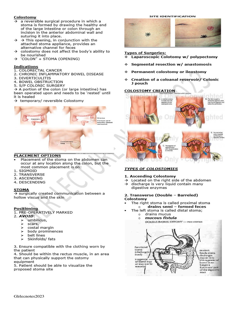 Colostomy Lecture Notes 2023 | PDF | Medical Specialties | Clinical ...