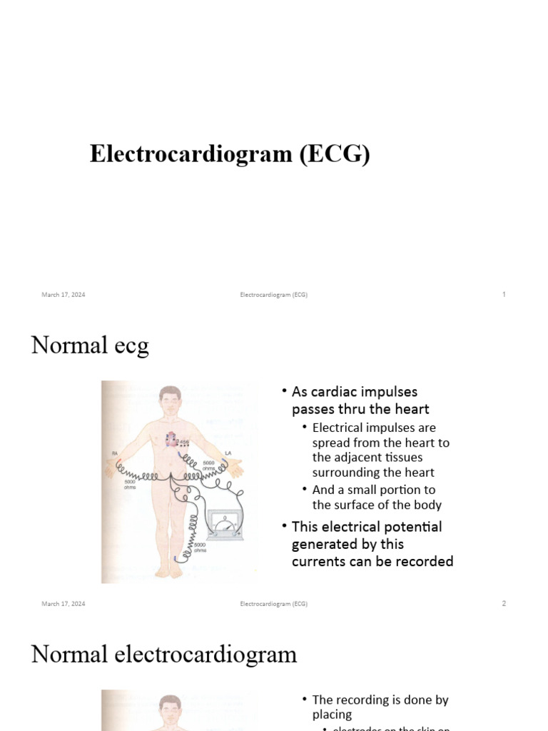 Electrocardiogram (ECG) | PDF | Electrocardiography | Heart