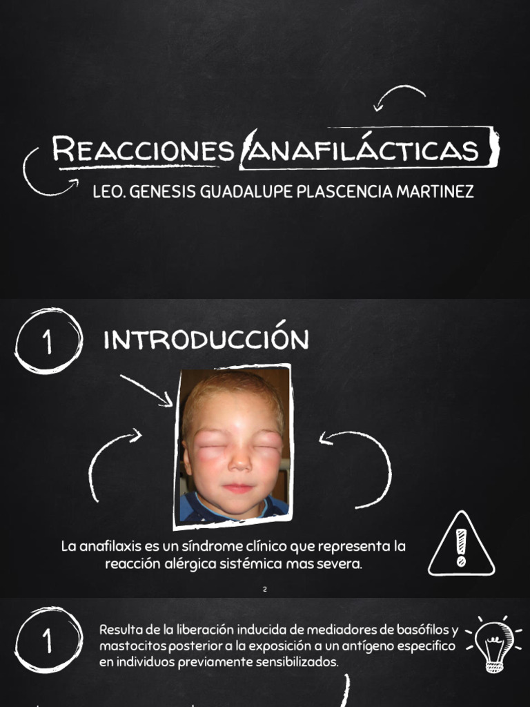 Reacciones Anafilácticas - Genesis Guadalupe Plascencia Martinez | PDF ...