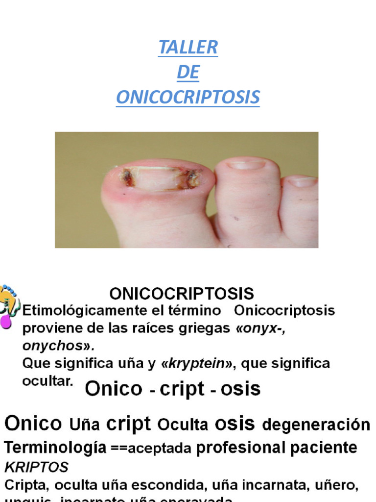 TALLER DE ONICOCRIPTOSIS | PDF