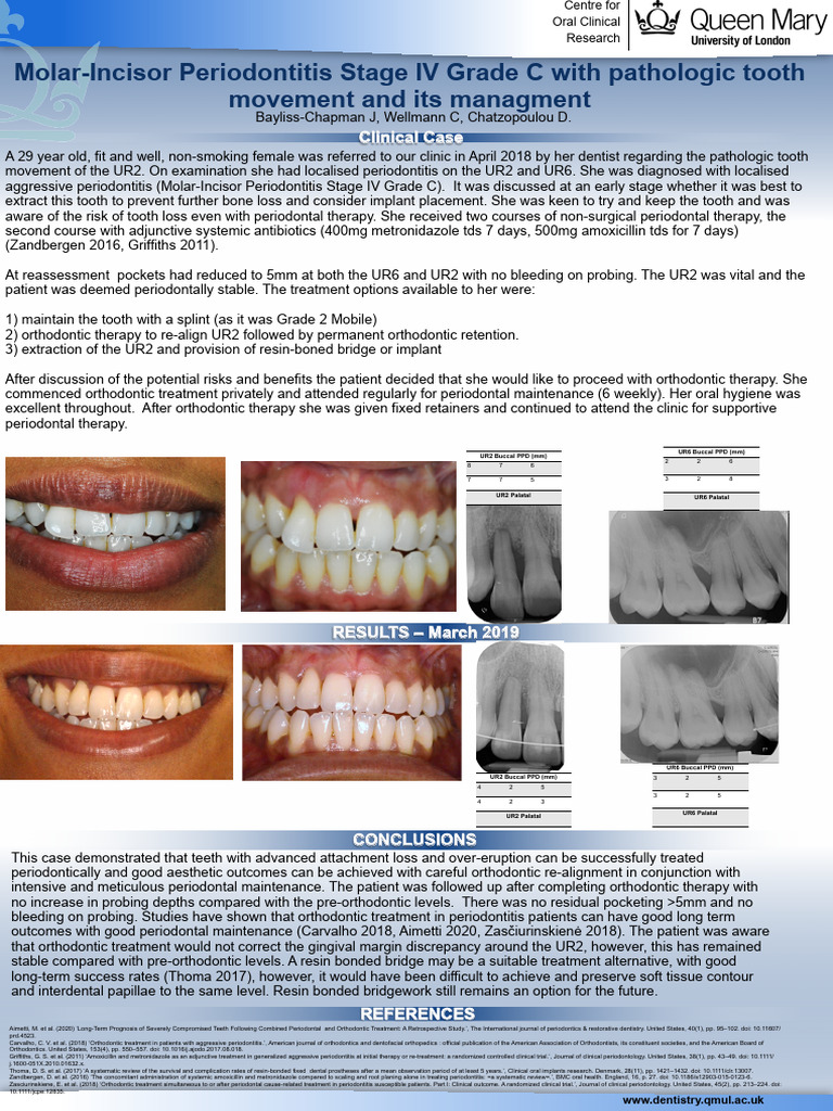 J_Bayliss_Chapman_POSTER_-_Molar-Incisor_Periodontitis_Stage_IV_Grade_C ...