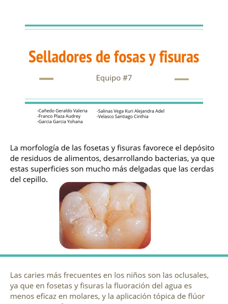 Selladores de Fosetas y Fisuras Dentales | PDF