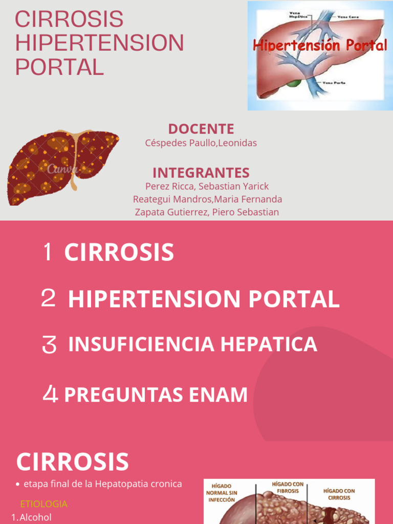 Cirrosis, Hipertension Portal | Descargar gratis PDF | Cirrosis | Especialidades Medicas