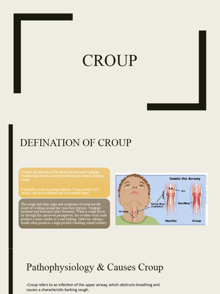 Croup Presentation | PDF