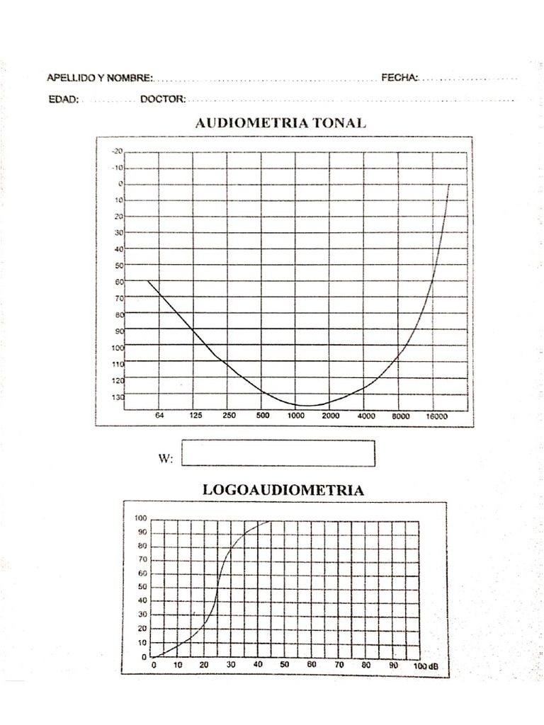 AUDIOGRAMA | PDF