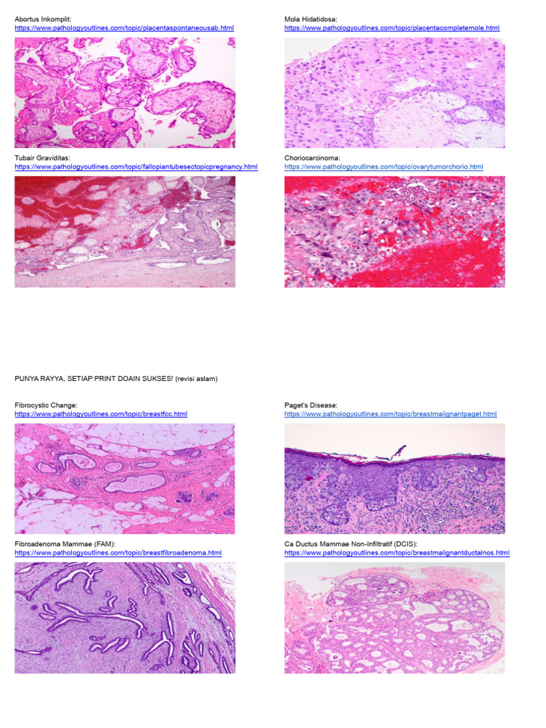Preparat PA 6.1 (revised) | PDF | Neoplasms | Cancer