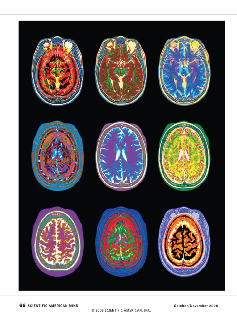 Skepticism Toward Brain Scan Interpretations | PDF | Functional ...