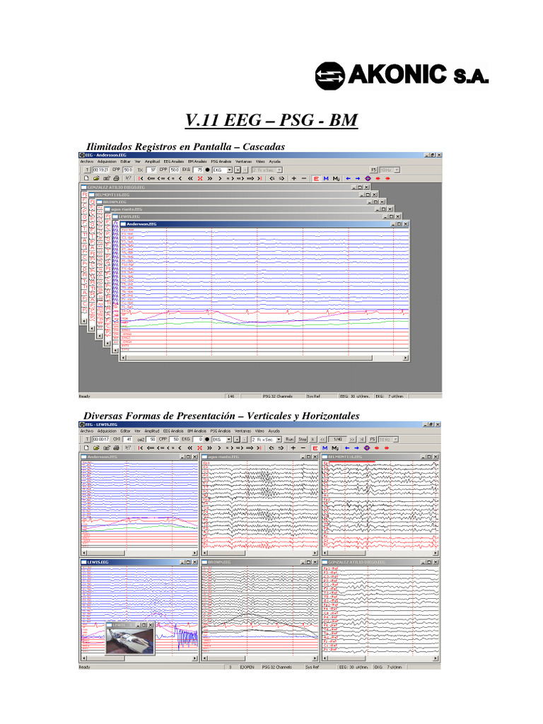 Software EEG y PSG V.11 para Windows | PDF | Ingeniería Informática ...