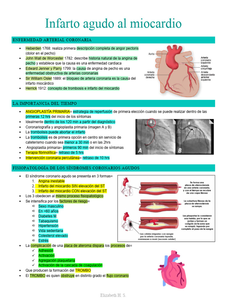Infarto Agudo Al Miocardio Curso | PDF | Infarto de miocardio | Especialidades Medicas