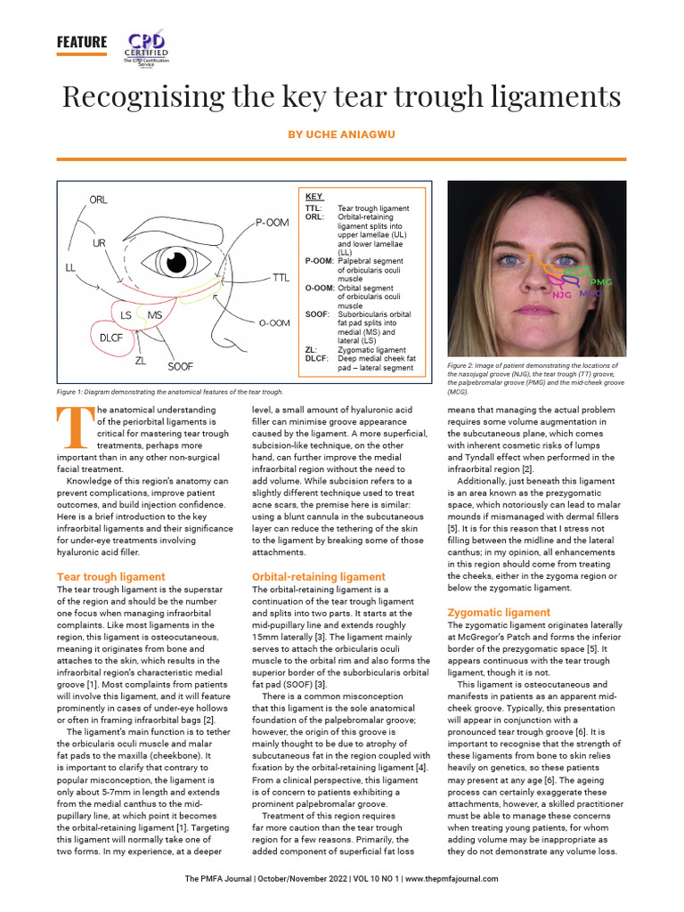 Pmfaon22 Tear Trough Final | PDF | Anatomy | Human Anatomy