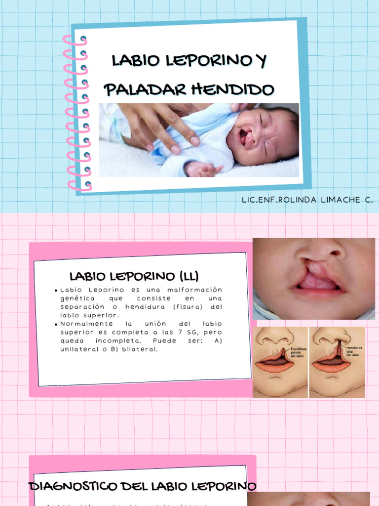 LABIO LEPORINO Y PALADAR HENDIDO | PDF | Medicina CLINICA | Ciencias de ...