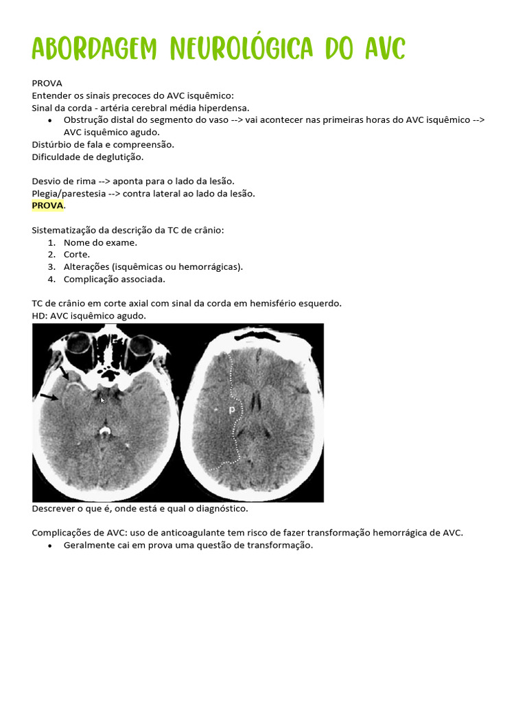 Abordagem Neurológica Do AVC | PDF | AVC | Causas de morte